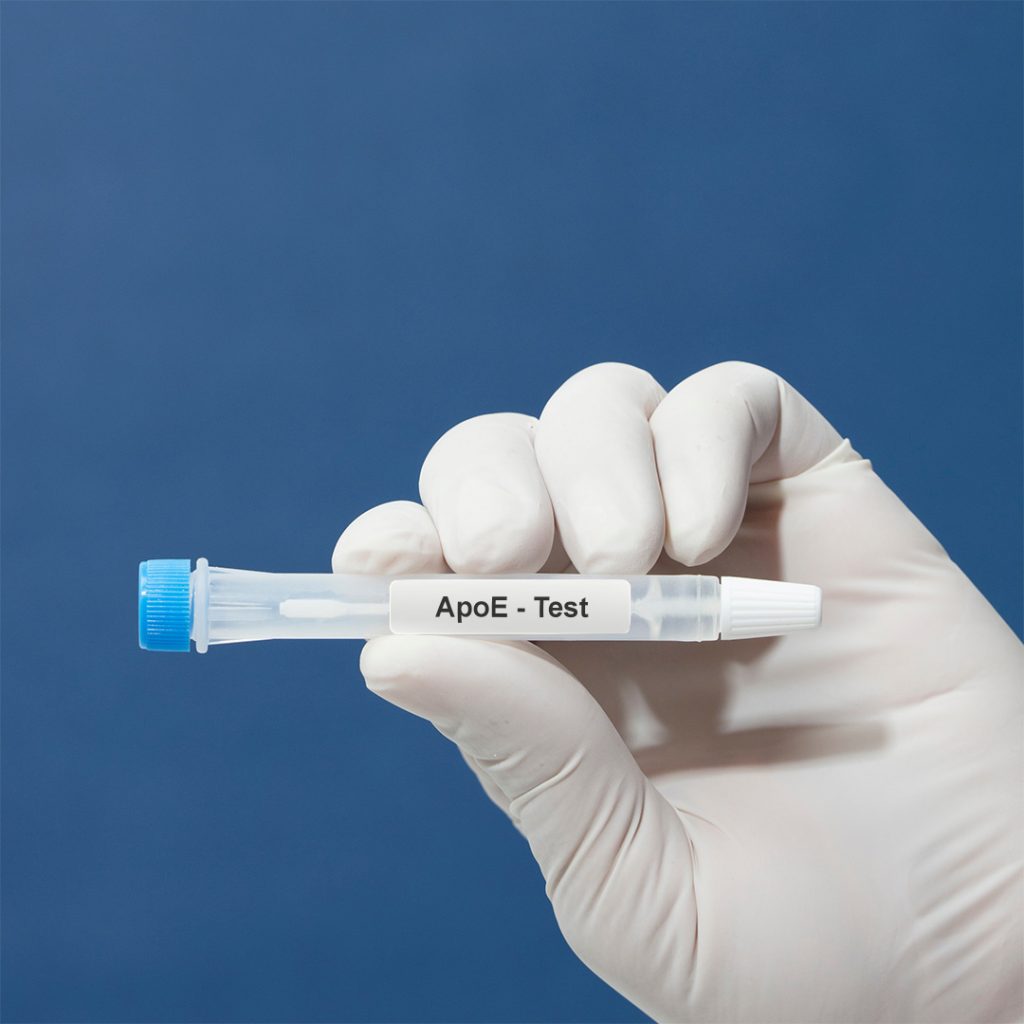 ApoE – Empire City Laboratories | Medical Lab Testing ANTIBODY PCR ...