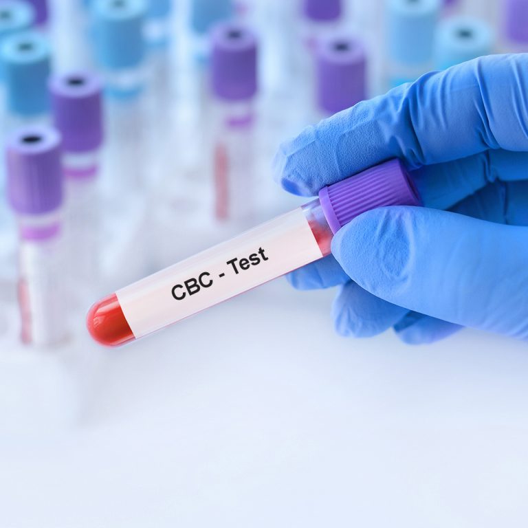 CBC – Empire City Laboratories | Medical Lab Testing ANTIBODY PCR COVID ...