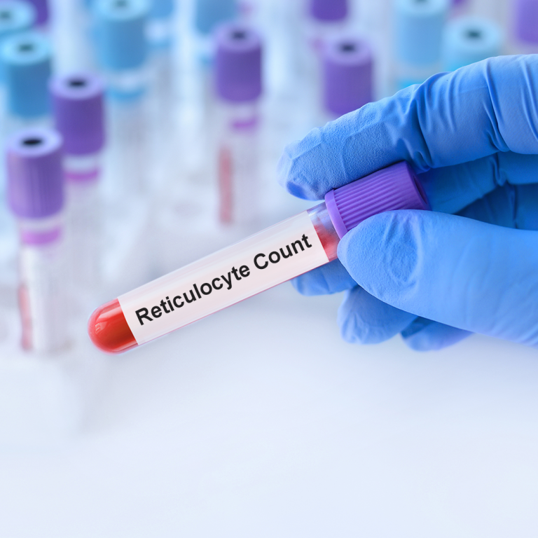 Reticulocyte Count – Empire City Laboratories | Medical Lab Testing ...